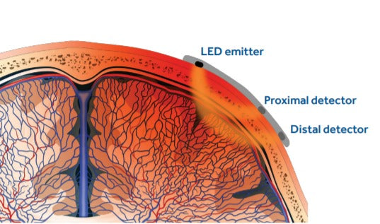 OXIMETRÍA CEREBRAL / SOMÁTICA Sistema INVOS ™ 7100– Manprec