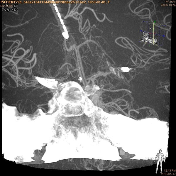 Xper XperGuide Software de intervención– Manprec